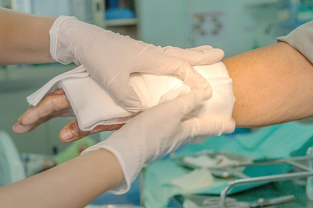 Scientists Develop Non invasive Technique To Assess Burn Wound Healing Scientists Develop Non invasive Technique To Assess Burn Wound Healing